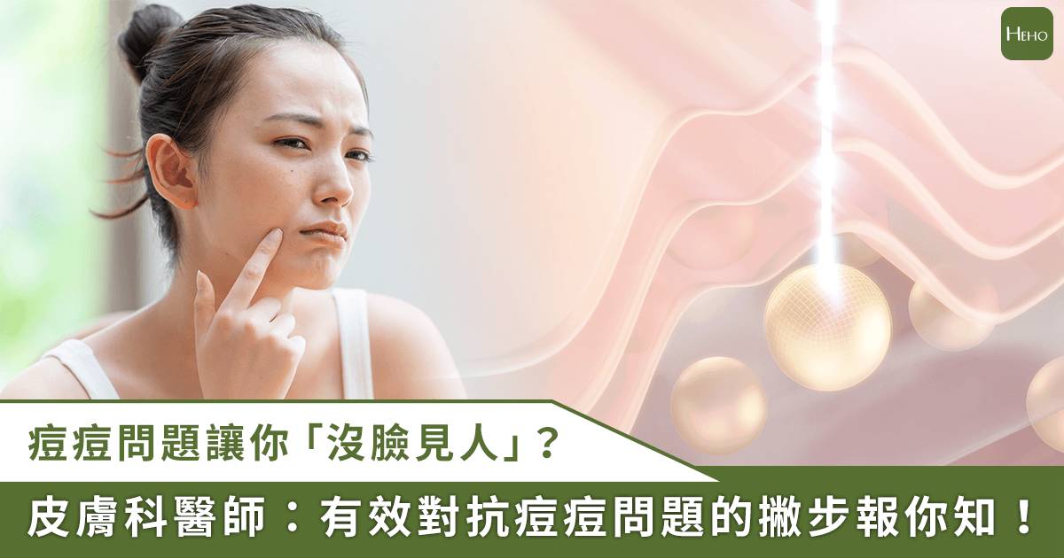 痘痘如何有效消滅？皮膚科醫分析「藥膏、口服藥、雷射」適用時機 | Heho健康 | LINE TODAY