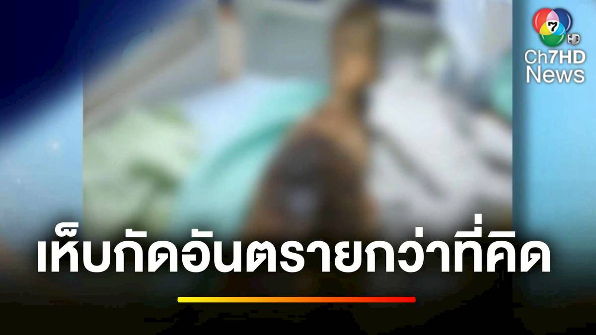 อุทาหรณ์ หนุ่มถูกเห็บกัด รุนแรงถึงขั้นตัดขาทิ้ง | ข่าวเย็นประเด็นร้อน ...
