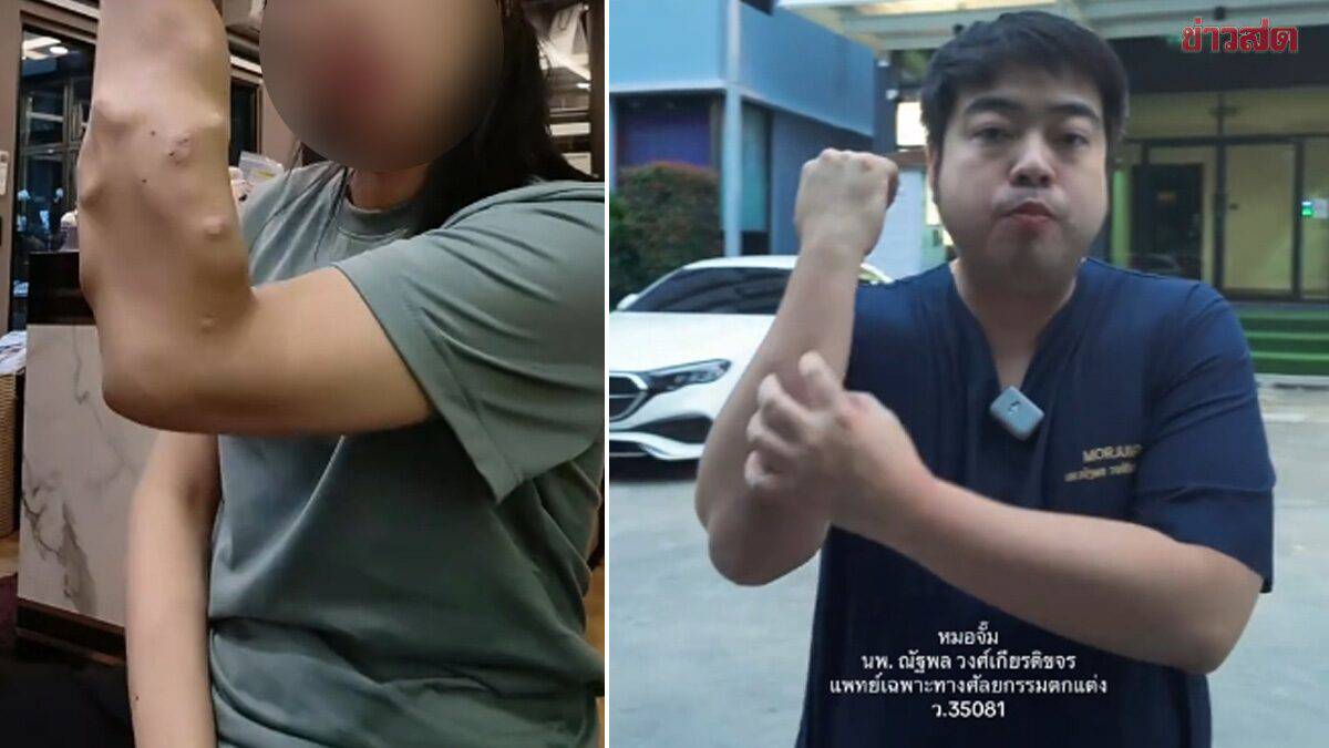 สาวป่วยไตระยะสุดท้าย เกิดจากปัสสาวะ หมอจั๊ม เผยพฤติกรรมเสี่ยง แนะวิธีป้องกัน | Khaosod | LINE TODAY